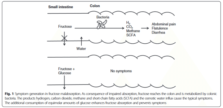 Fructose Malabsorption: A Beginner's Guide to Treatment