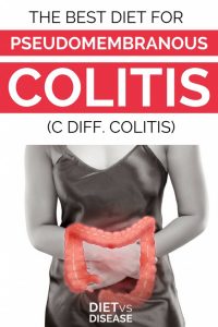 Beginner’s Guide To Beating Pseudomembranous Colitis (C. diff Colitis ...