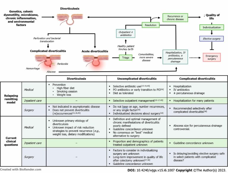 How To Treat Diverticulitis: The 2 Steps You Need To Know | Diet vs Disease